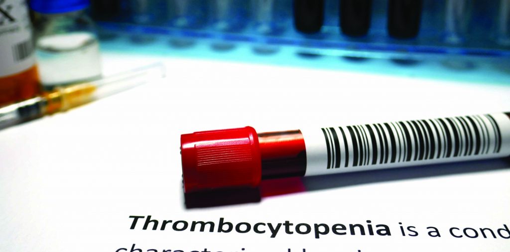 A Practical Approach To Thrombocytopenia The Medical Republic a-practical-approach-to-thrombocytopenia-the-medical-republic